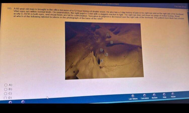 CBSE NBME Premium Recalls/Past Papers Package 2024-2025: Score Boostin ...